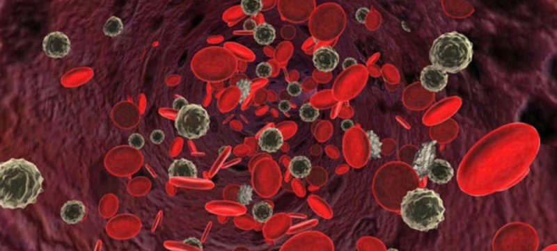 7 Important Facts You Should Know About Blood Cancer in India | Latest ...